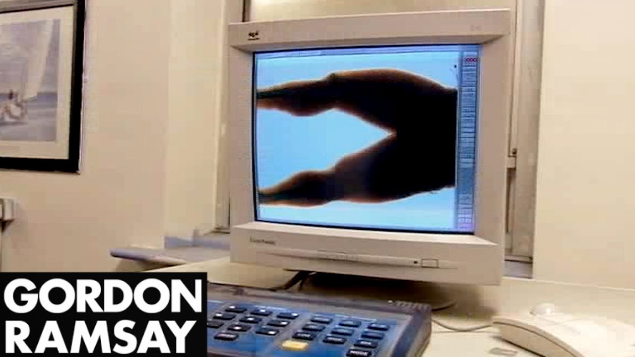 Gordon Ramsay X-Rays Himself | Gordon Behind Bars - The Cook Book